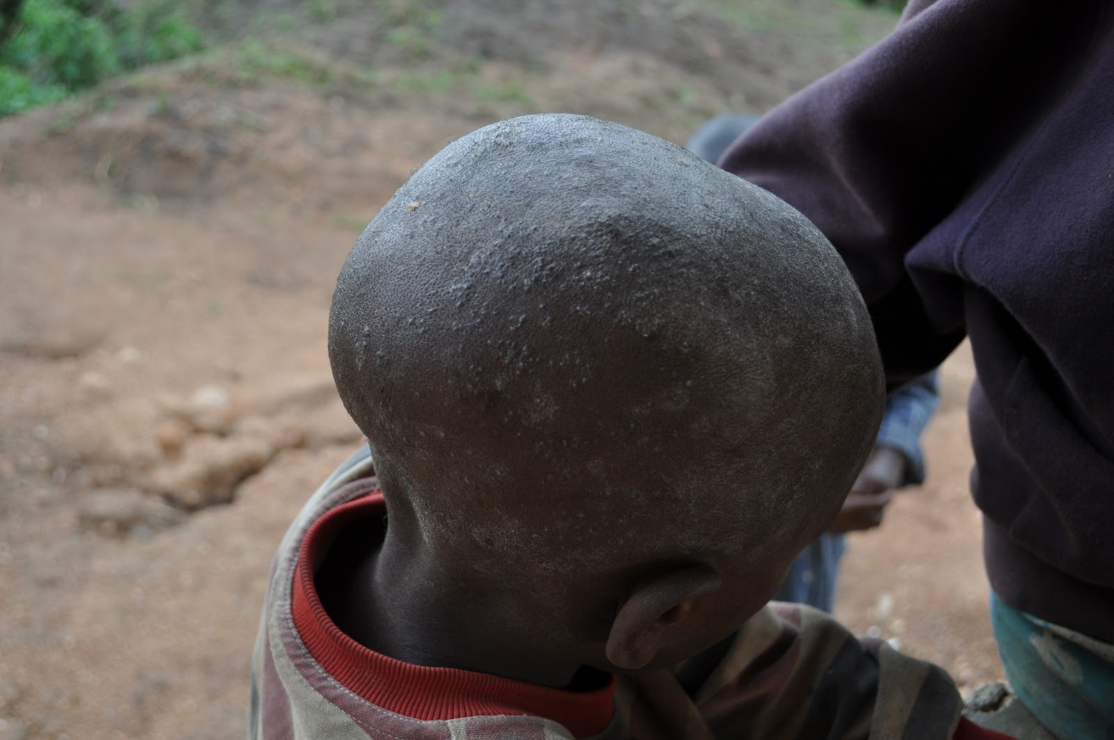 A Corporate Exchange: What's that white stuff on their heads?