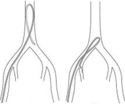 The Pump and the Tubes: The Uterine Artery