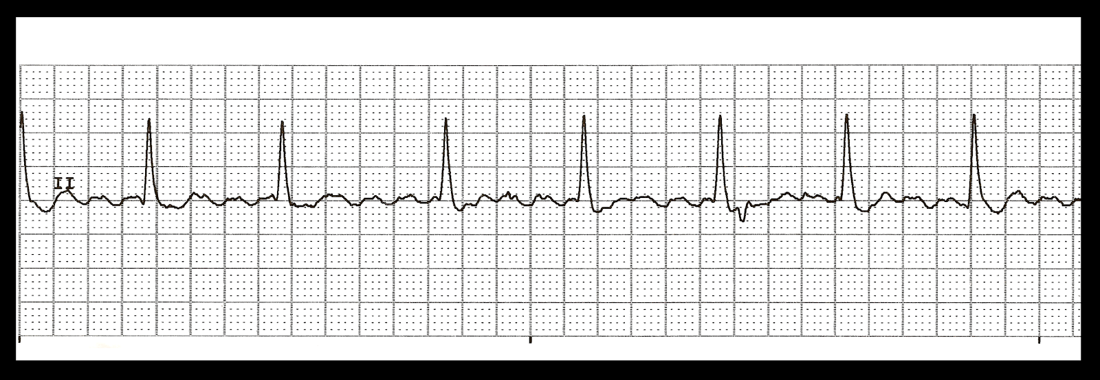 Practice EKG Strips 337