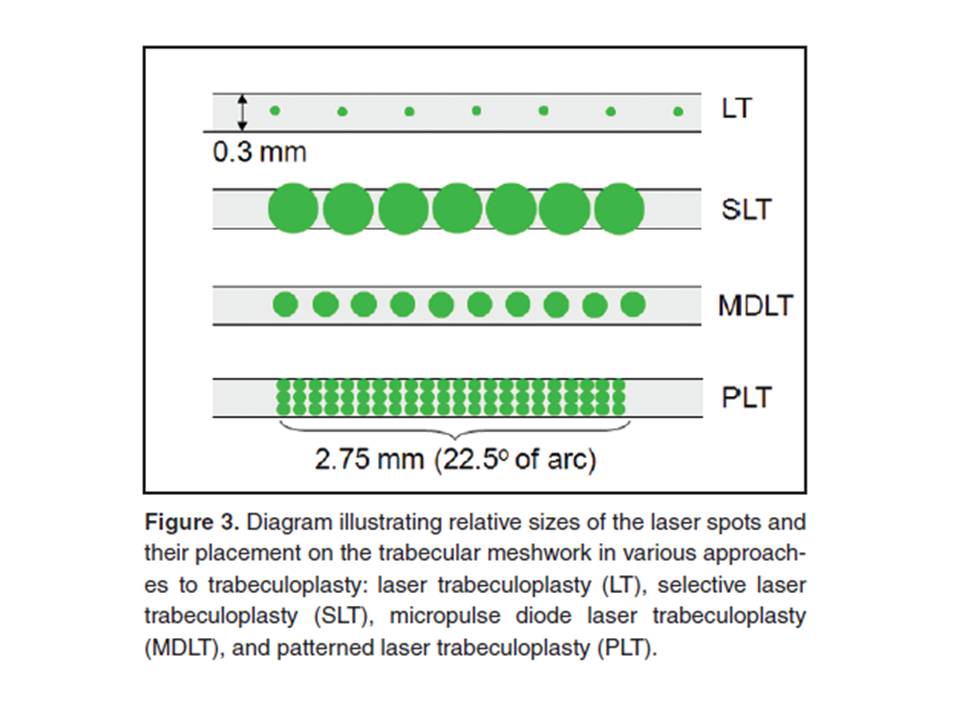 GLAUCOMA SPECIALIST BLOG: "THE GLOG"
