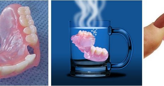 Gigi Tiruan Lepasan Valplast / Flexy ~ TRISULA DENTAL LAB