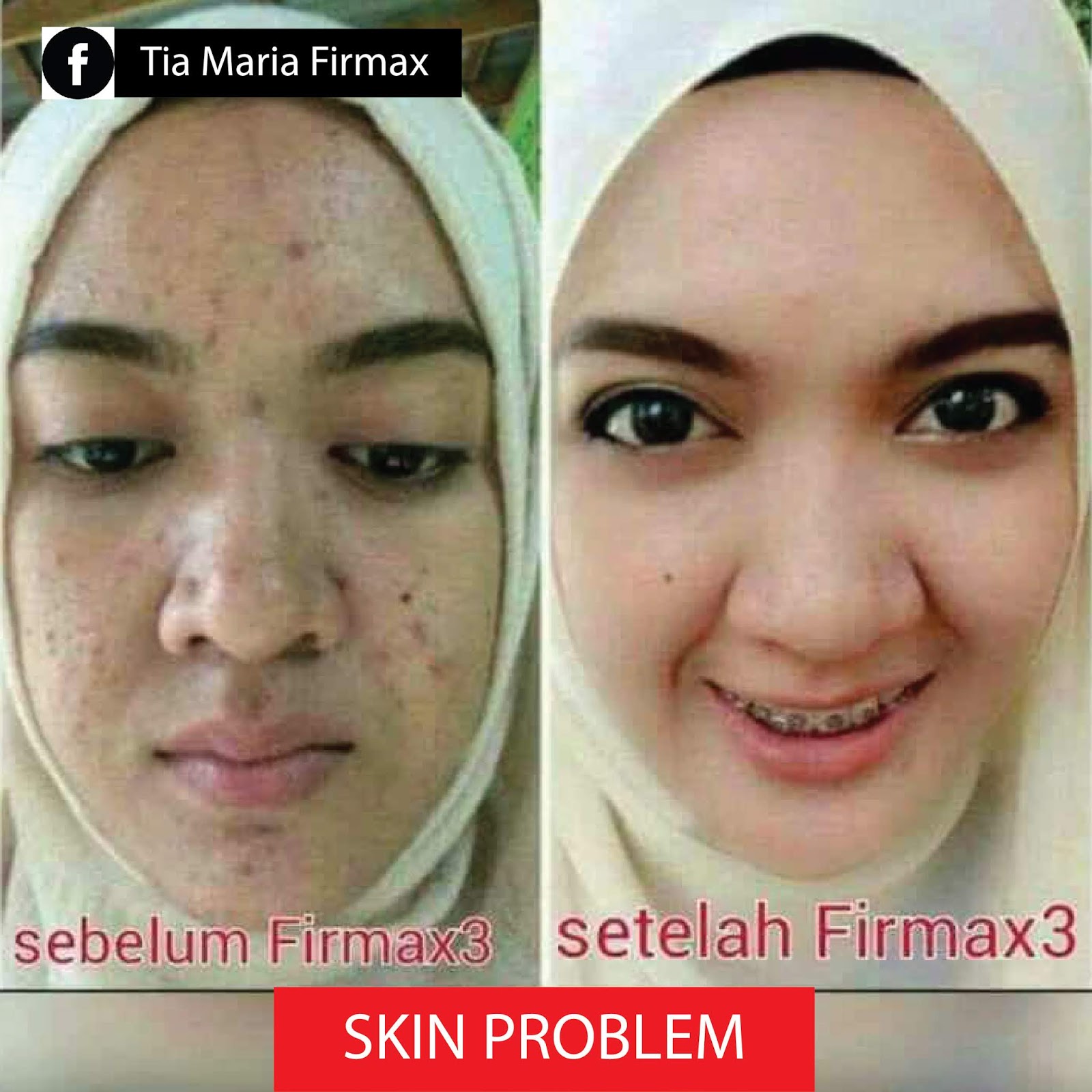 Testimoni Firmax3