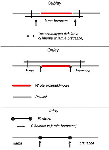 Actualités Scientifiques - Médicales: juin 2017