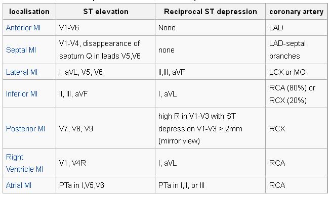 Lokalisasi Infark Miokard dan Pembuluh Darah yang terkena | INA - ECG