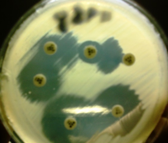 Microbiología Clínica: clases, casos interesantes y otros.: 2013