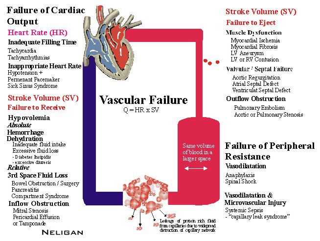 Health Updates Shock health-updates-shock