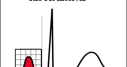 How to read an Electrocardiogram (ECG) - Part 4, The PR Interval ...
