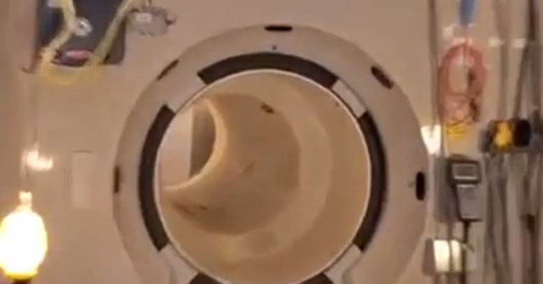 METAL OBJECTS INTO MRI MACHINE. - Best Right Way