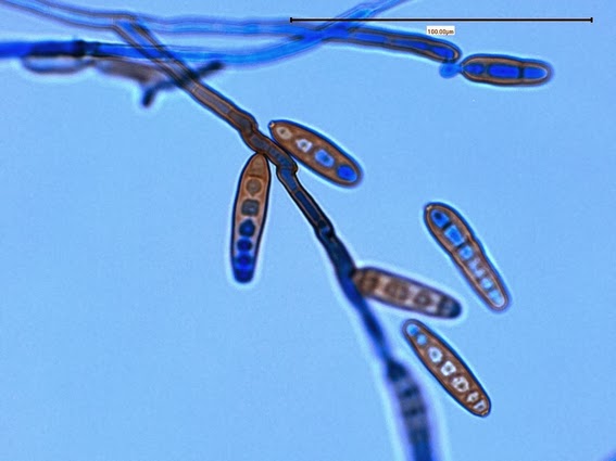 Fun With Microbiology (What's Buggin' You?): Exserohilum rostratum