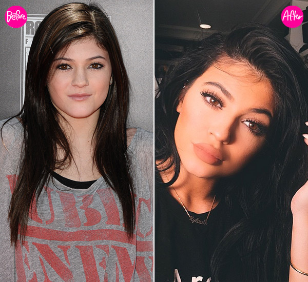 Before and After Kardashians and Jenner - Kardashians