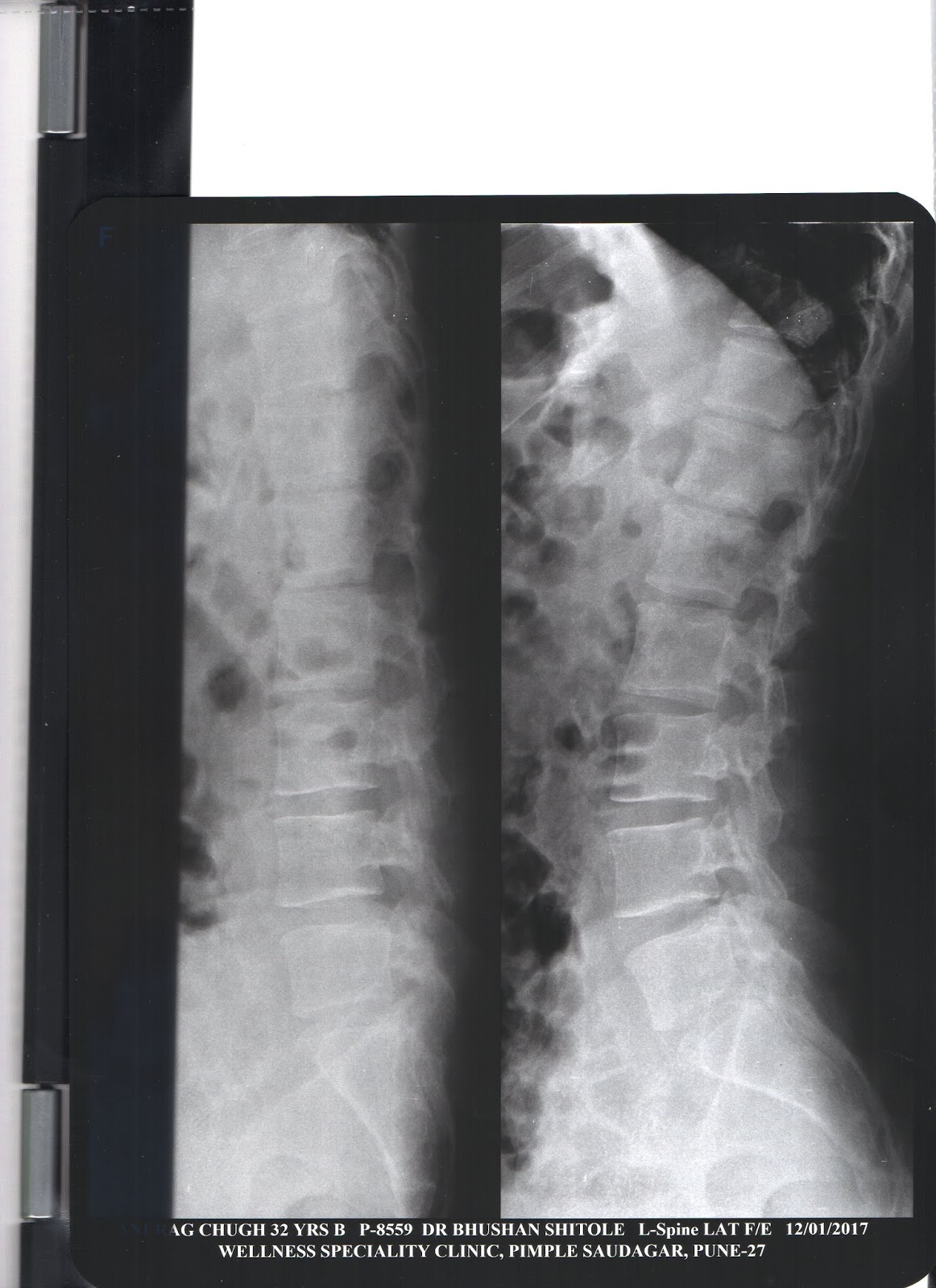 Scanning X-Ray Films