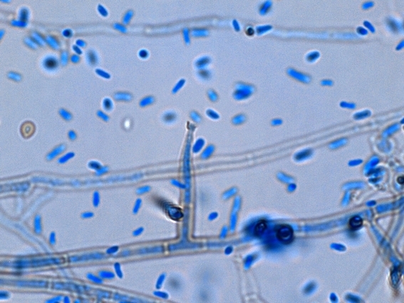 Fun With Microbiology (What's Buggin' You?): Pleruostomophora richardsiae