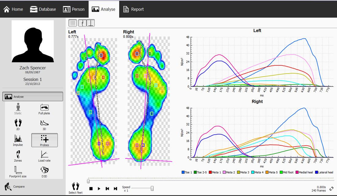 ORTOPEDIA BOSTON: Que es el Footscan®? Tecnología a tus pies ... ahora ...
