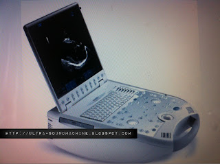 Ultra Sound Machine: Biosound Caris Portable Ultrasound
