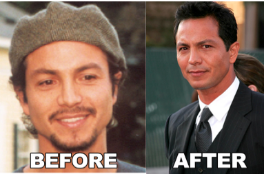 Sandi J. Woods Blogs: Has Benjamin Bratt Plastic Surgery Before and After Nose Job Images