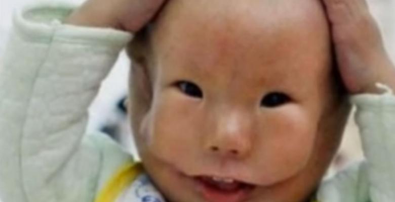 Ce petit garçon a moins de 2 ans et doit subir les conséquences de sa ...