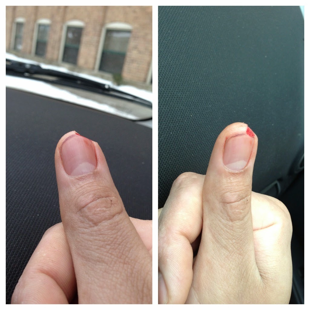 CHEF: 5- ¿QUE RIESGOS CORRE AL SER CHEF?