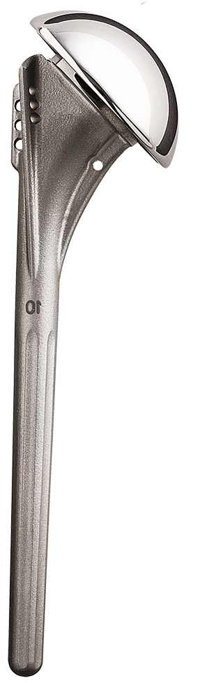 UW Shoulder and Elbow Academy: How is the roundness of the humeral head ...