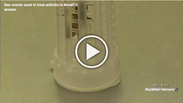 Apitherapy News: Bee Venom Used to Treat Arthritis