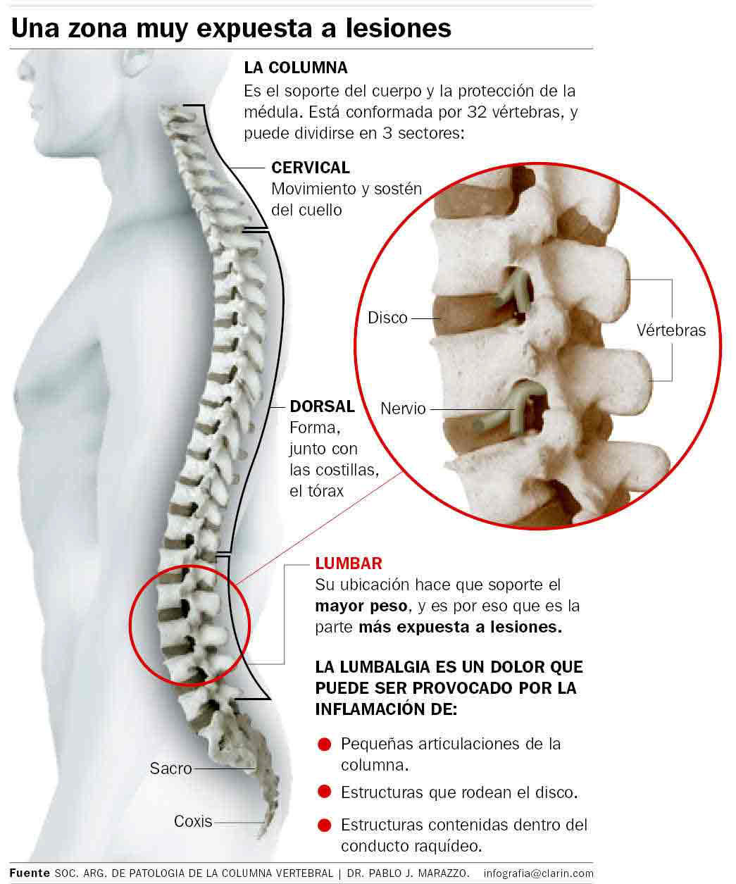 Atención de Pacientes : Marco Teórico, Respecto del Manejo Manual de Carga