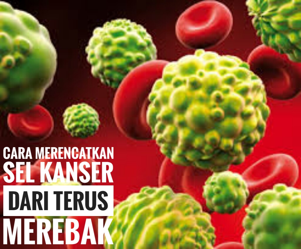 Cara untuk mematikan sel kanser dari terus merebak | permatahatibidadariku