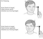 Fitnesspedia: Vertigo Exercises