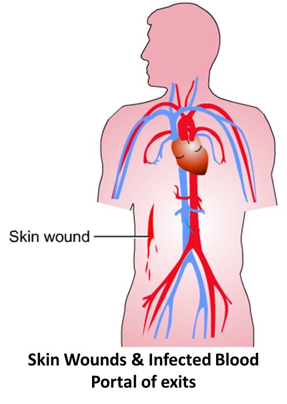 Bacterial Transmission ~ Zero-Infections