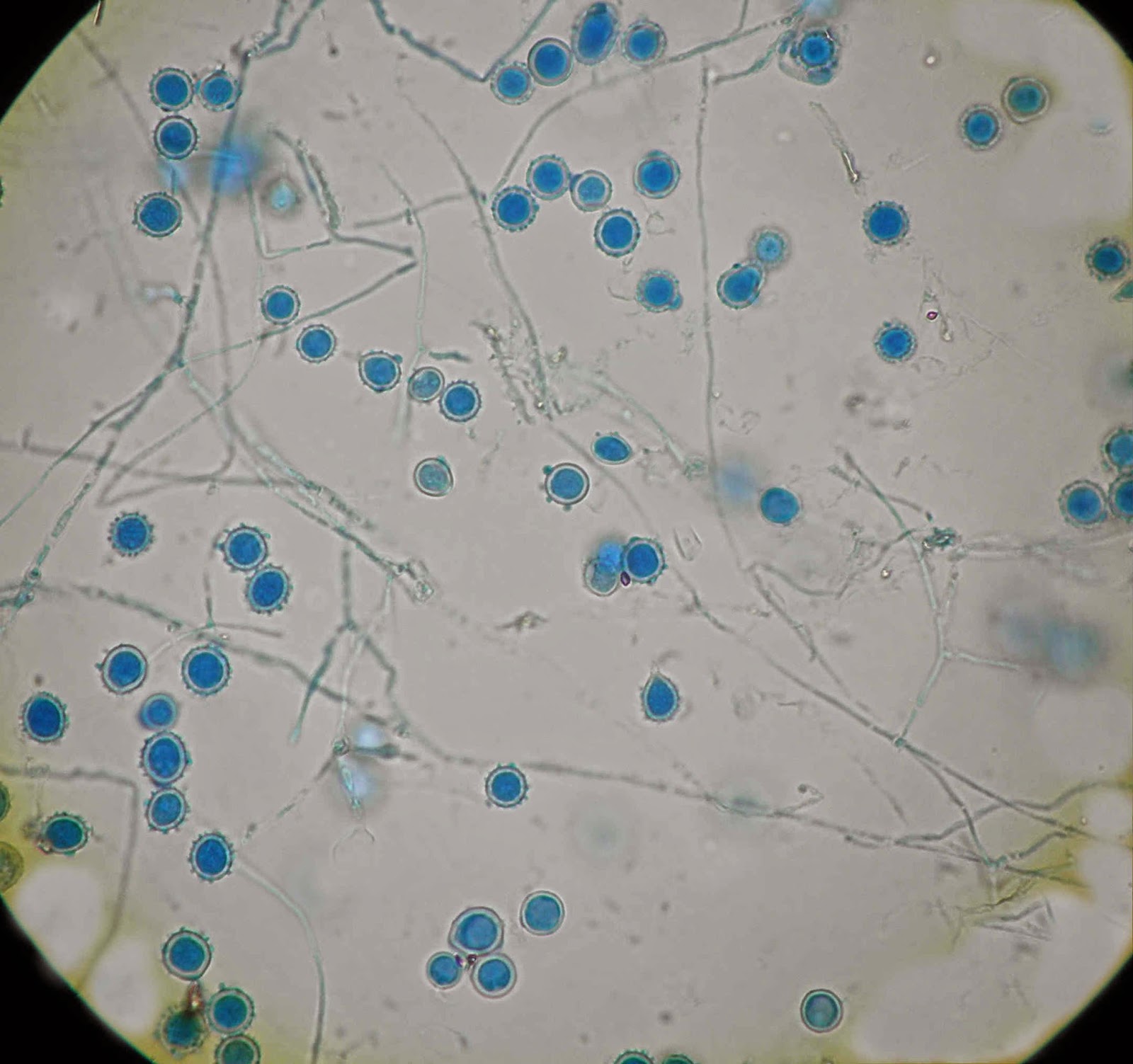 ATLAS MICOLOGIA: CONIDIOBOLUS CORONATUS