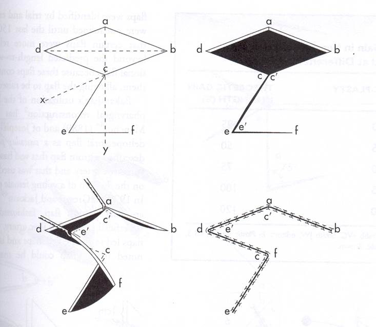 Curso de Cirugía Plástica CiruplasMedia: Colgajos