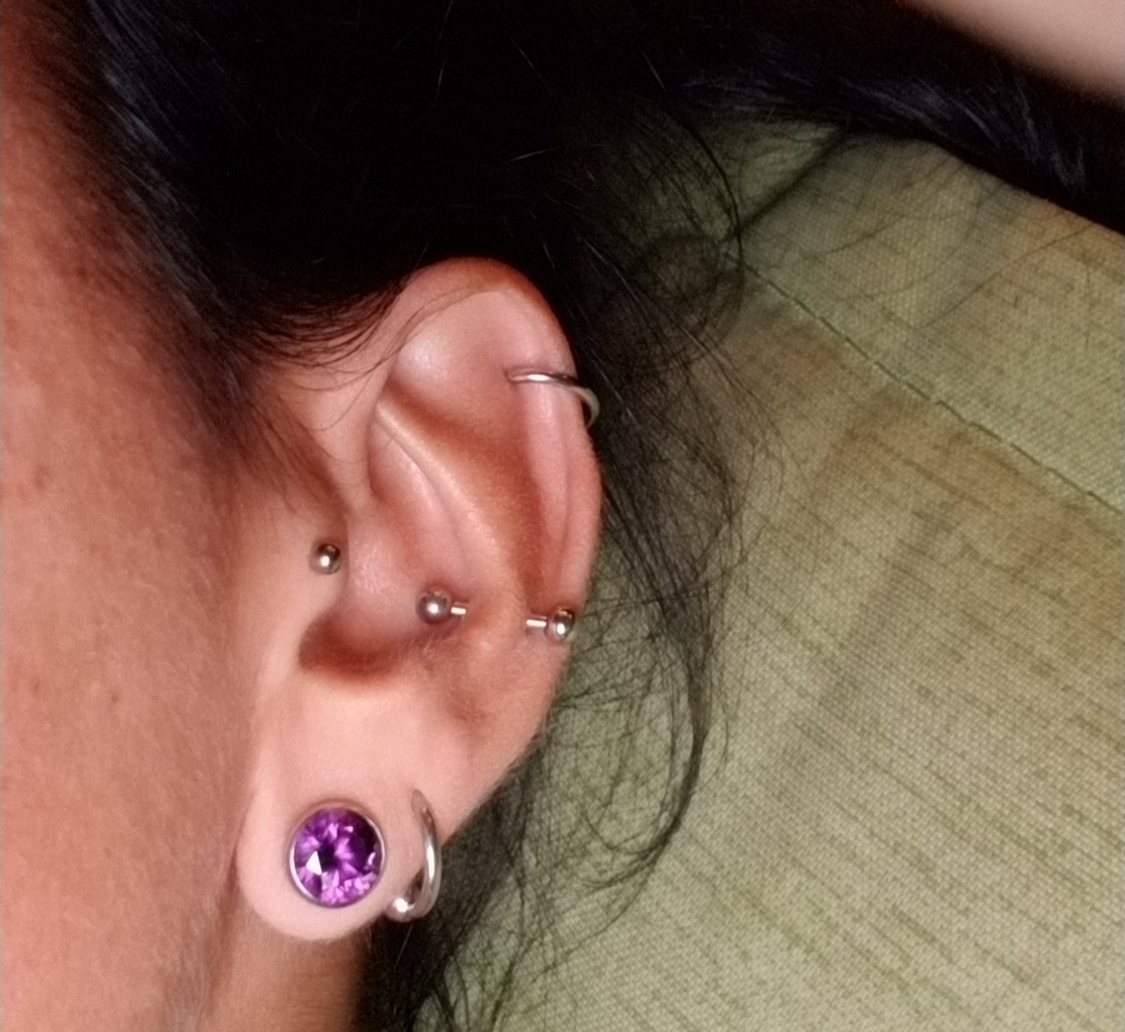 Infected snug piercing healed