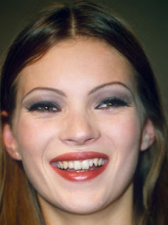 list of celebs: Celebrities with Bad Teeth