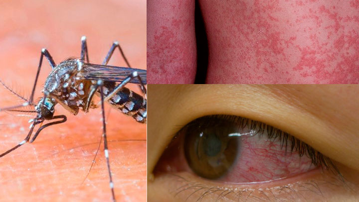 Qué es el virus Zika? - Ecuador Noticias