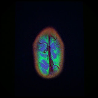 Nevit's blog: Color MRI of the BRAIN