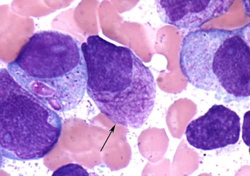 VETERINARY HEMATOLOGY DEXTERVET: AML-M3 faggot cell