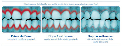 GlamourCaprices: AZ Pro-Expert Protezione Gengive: Review ed Analisi ...