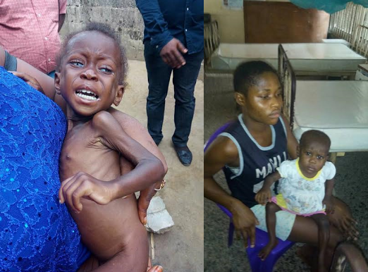 Photos: Severely malnourished baby rescued in Calabar is better and ...