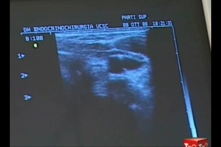 Channel7: Gjendra Tiroide