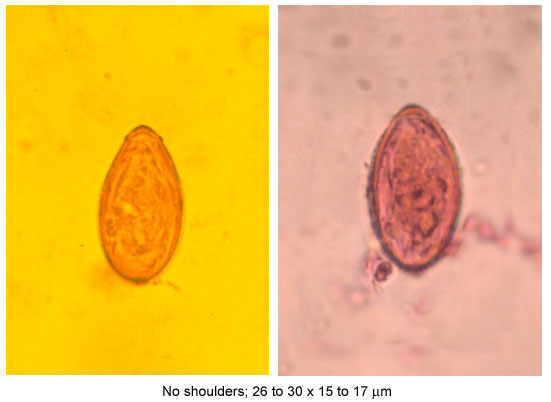 Lecture Notes in Medical Technology: Lecture #9: THE INTESTINAL FLUKES