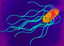 Infection Landscapes: Salmonellosis