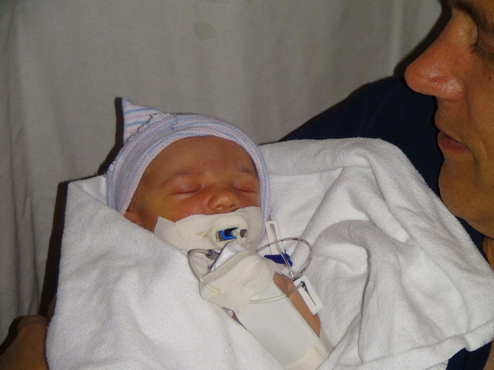 Leafde hat wun!: Choane Atresie