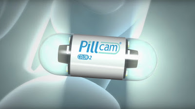 PillCam to diagnose and support Endoscopy and Colonoscopy! - Silicon ...