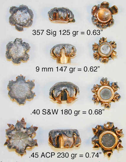 Priyanjith's Forensic Medicine & Medical Ethics: Bullet injury with ...