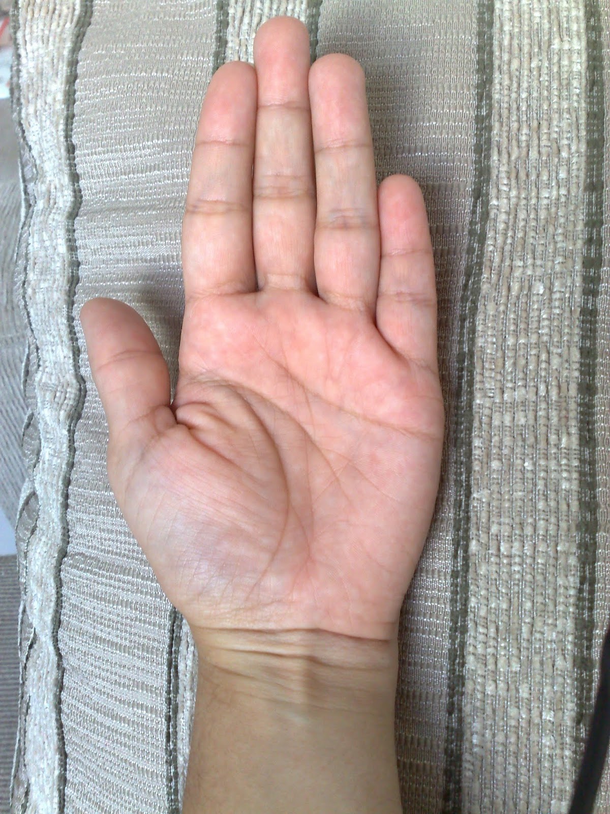 Marcas nas maos e sinais na palma da mao