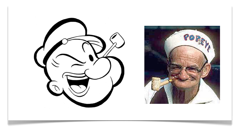 -- Dr. 陳瑞鋒 的 BLOG 二部曲--: 中臉 凹陷 ( Midface Retrusion: POPEYE FACE )