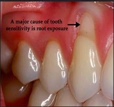 Omni Dental Group: Sensitive Teeth