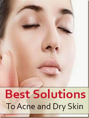 Best Solutions to Acne and Dry Skin | Skin Care And Health Tips