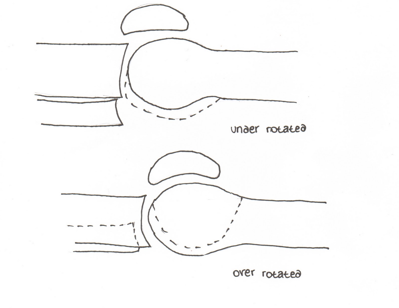 X-Ray Vision - A Radiography Blog: Lateral Knees - How to fix them when ...