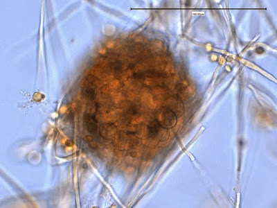 Fun With Microbiology (What's Buggin' You?): Eurotium herbariorum ...