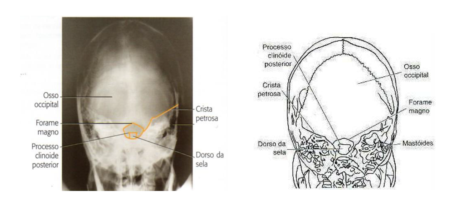 Laboratório de Roentgen: Crânio e Face