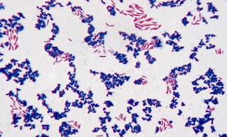 GRAM STAIN TECHNIQUE TO IDENTIFY BACTERIA - Healthy life blog